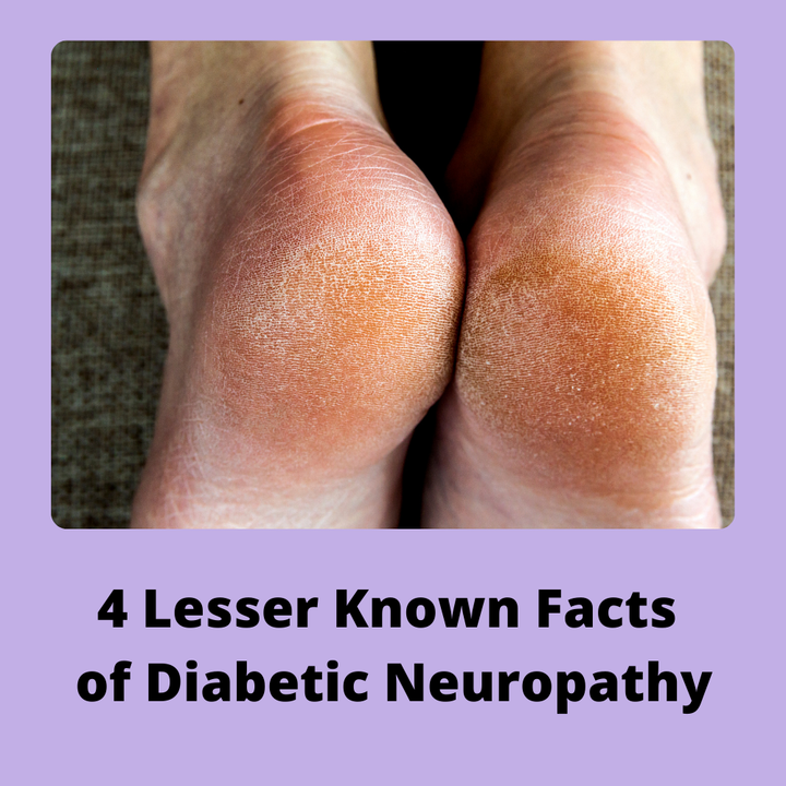 4 Lesser Known Facts about Diabetic Neuropathy – Aromalief